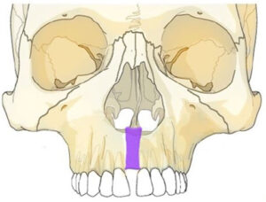 Nasomaxillary Expansion Treatment in Palo Alto, CA
